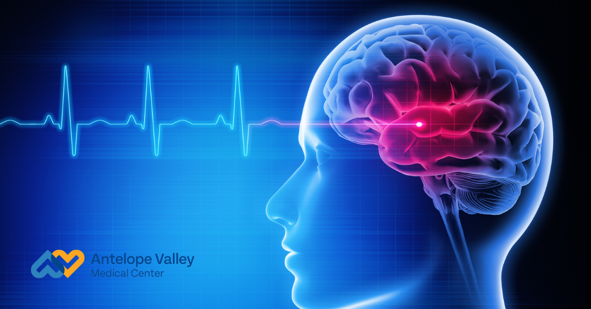What to Do in Case of a Stroke